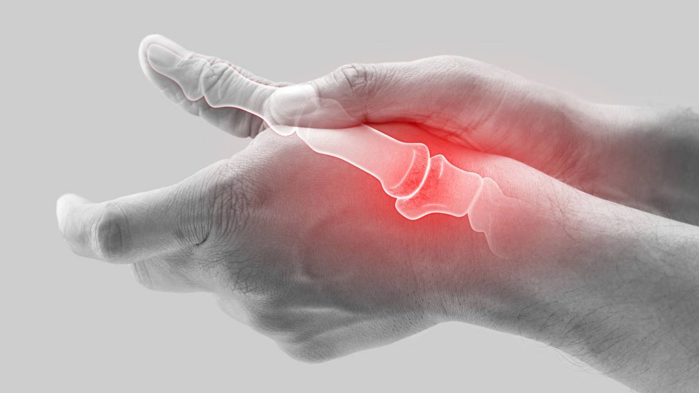 Success with Treat-to-Target Therapy in Rheumatoid Arthritis Lasts Up ...