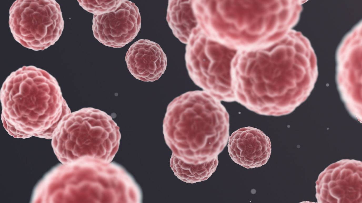 New Algorithm Helps Detect Aggressive Basal Cell Carcinoma for Optimal ...