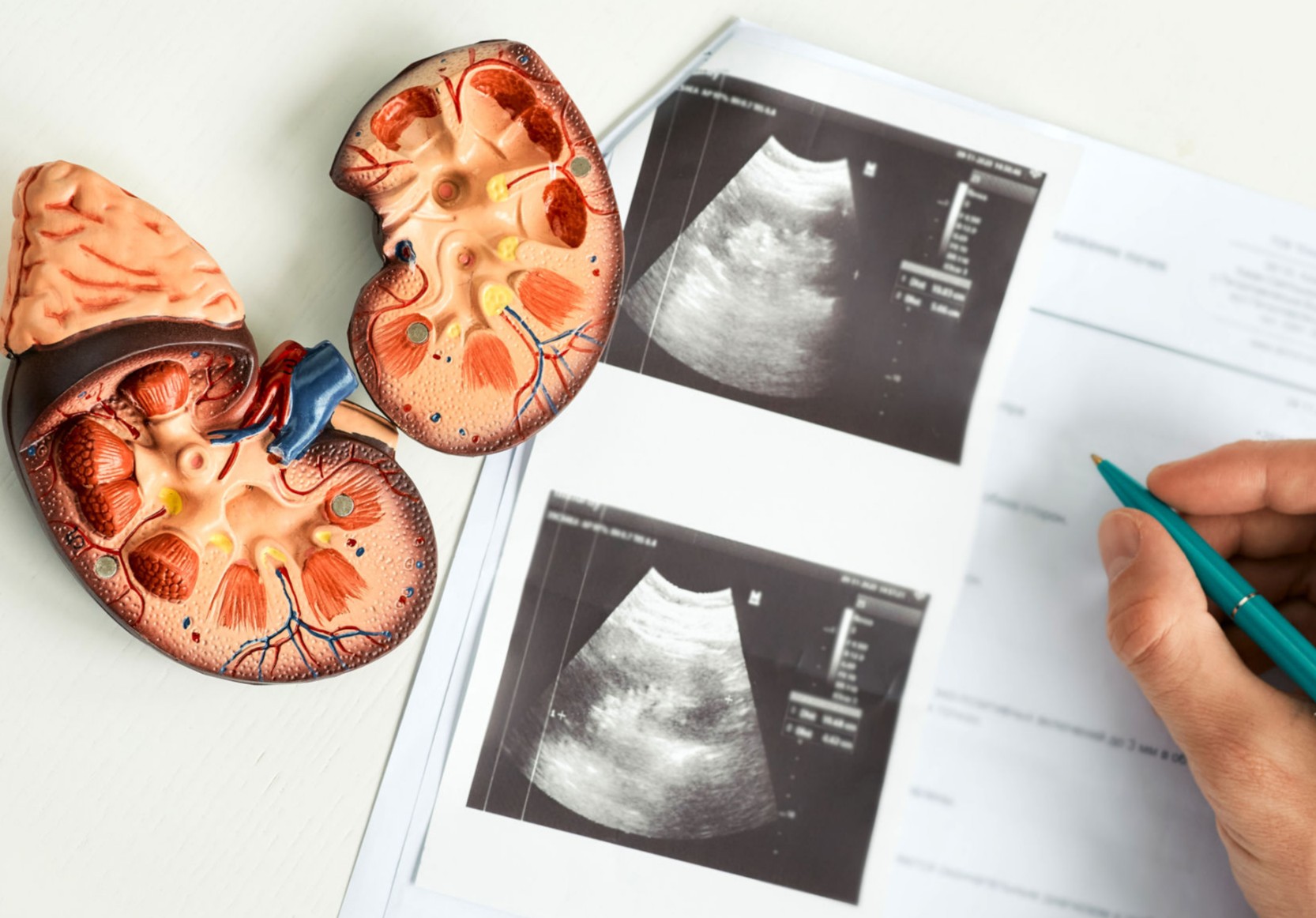 Ultrafast Ultrasound: First Successful Contrast Agent-Free Imaging of ...